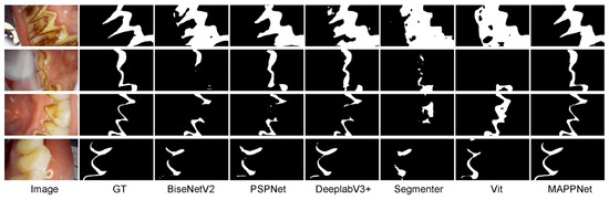MAPPNet: A Multi-Scale Attention Pyramid Pooling Network for Dental ...