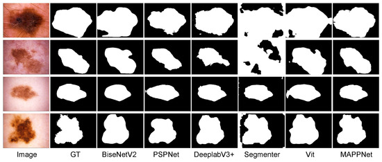 MAPPNet: A Multi-Scale Attention Pyramid Pooling Network for Dental ...