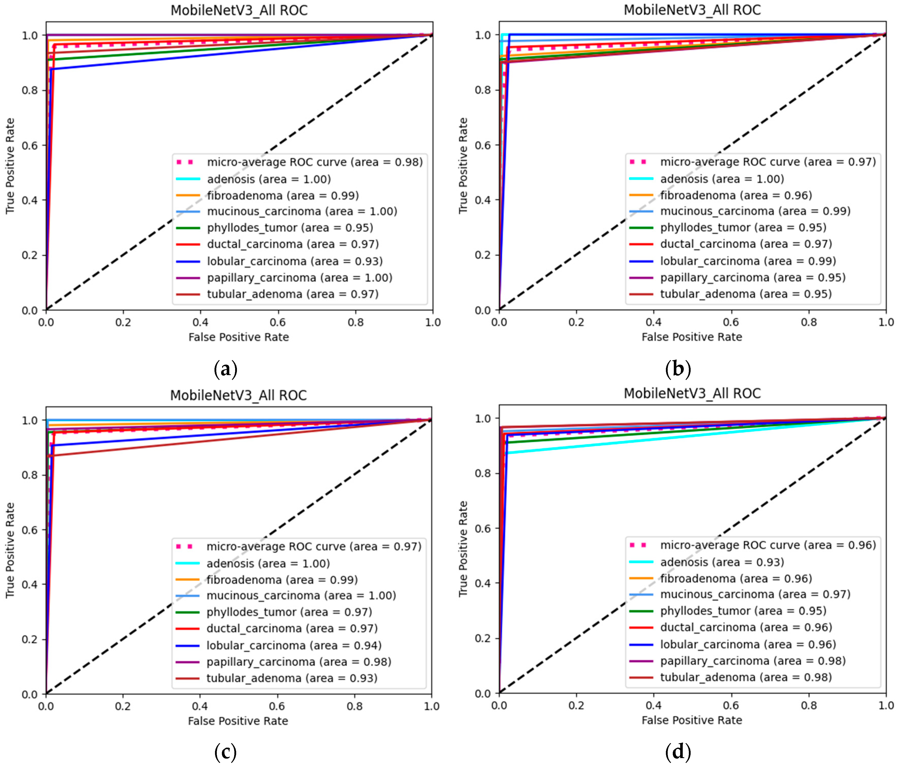 A Modified MobileNetV3 Model Using an Attention Mechanism for Eight-Class Classification of ...