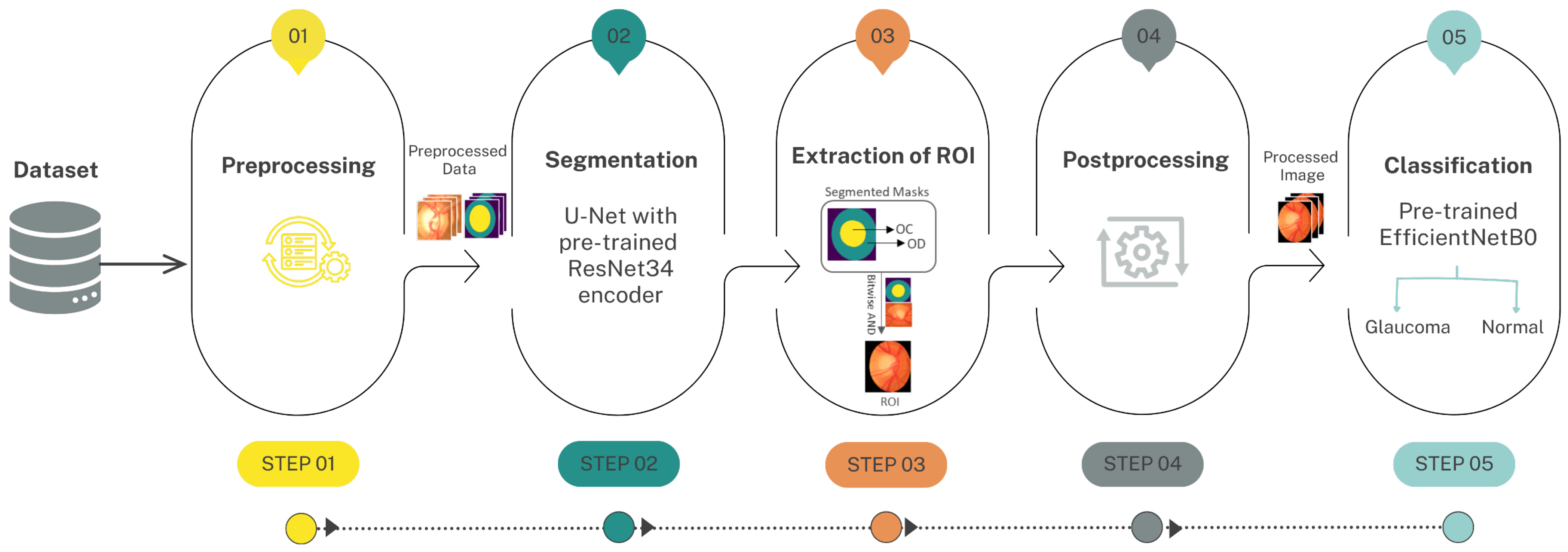 Optimizing Glaucoma Diagnosis with Deep Learning-Based Segmentation and Classification of ...
