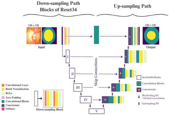 Optimizing Glaucoma Diagnosis with Deep Learning-Based Segmentation and Classification of ...