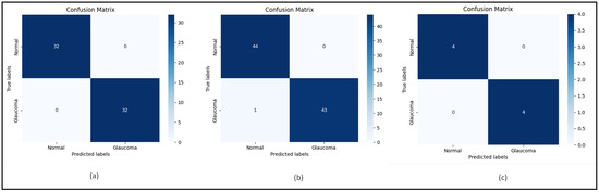 Optimizing Glaucoma Diagnosis with Deep Learning-Based Segmentation and Classification of ...