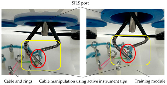 On the Control and Validation of the PARA-SILSROB Surgical Parallel Robot