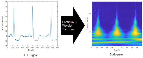 An Ensemble Deep Neural Network-Based Method for Person Identification Using Electrocardiogram ...