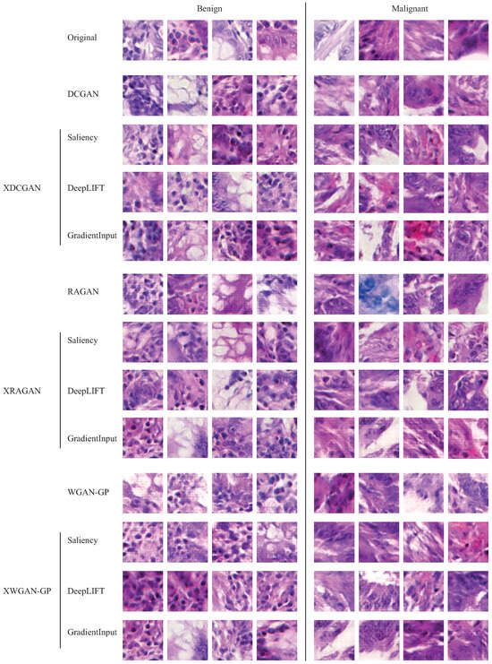 Data Augmentation in Histopathological Classification: An Analysis Exploring GANs with XAI and ...