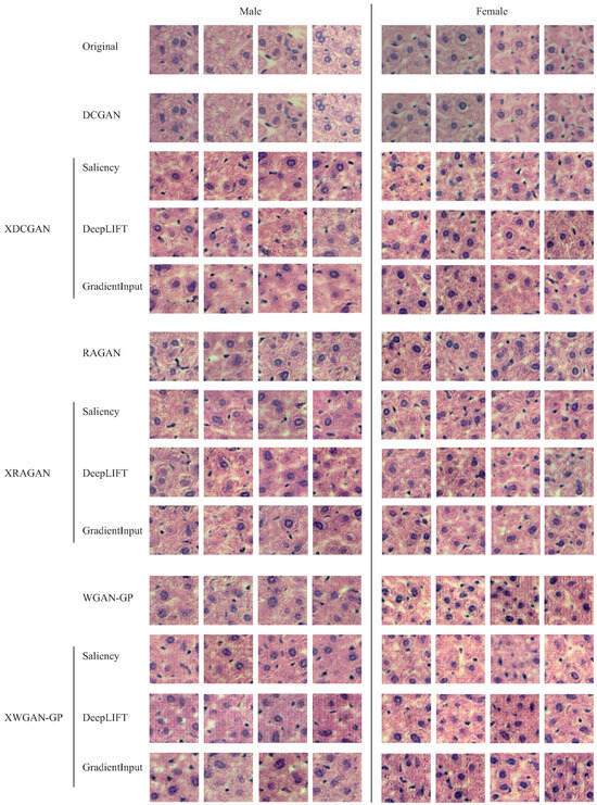 Data Augmentation in Histopathological Classification: An Analysis Exploring GANs with XAI and ...