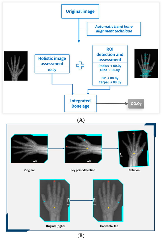 A Comparison of Automatic Bone Age Assessments between the Left and ...