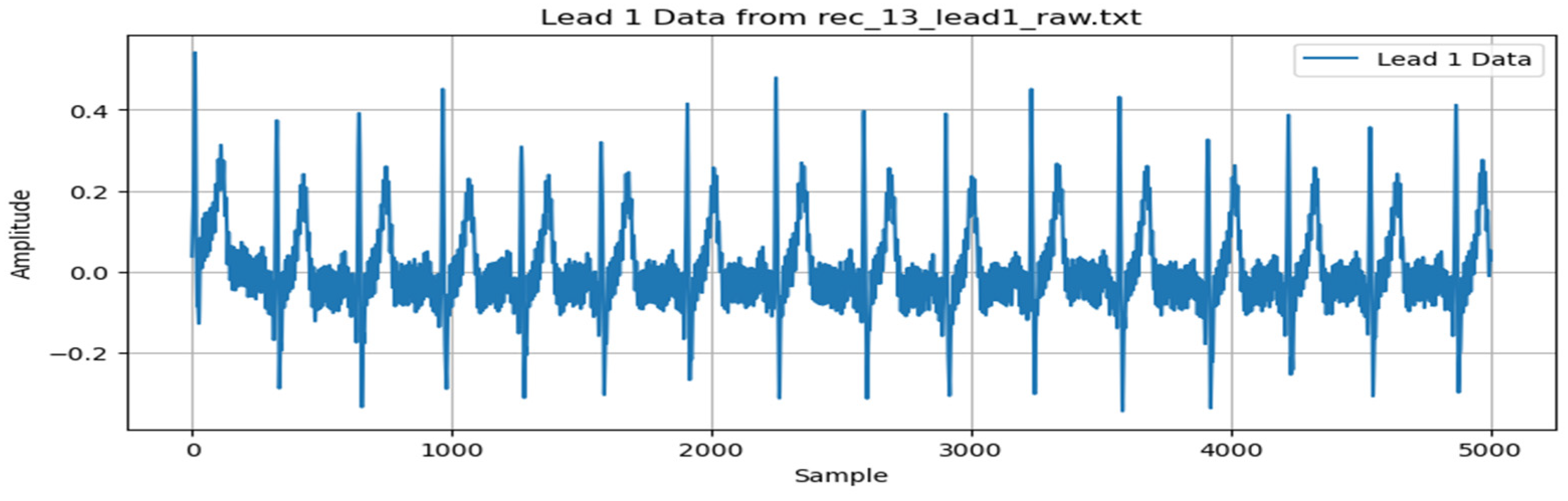 Comparative Evaluation of Neural Network Models for Optimizing ECG Signal in Non-Uniform ...