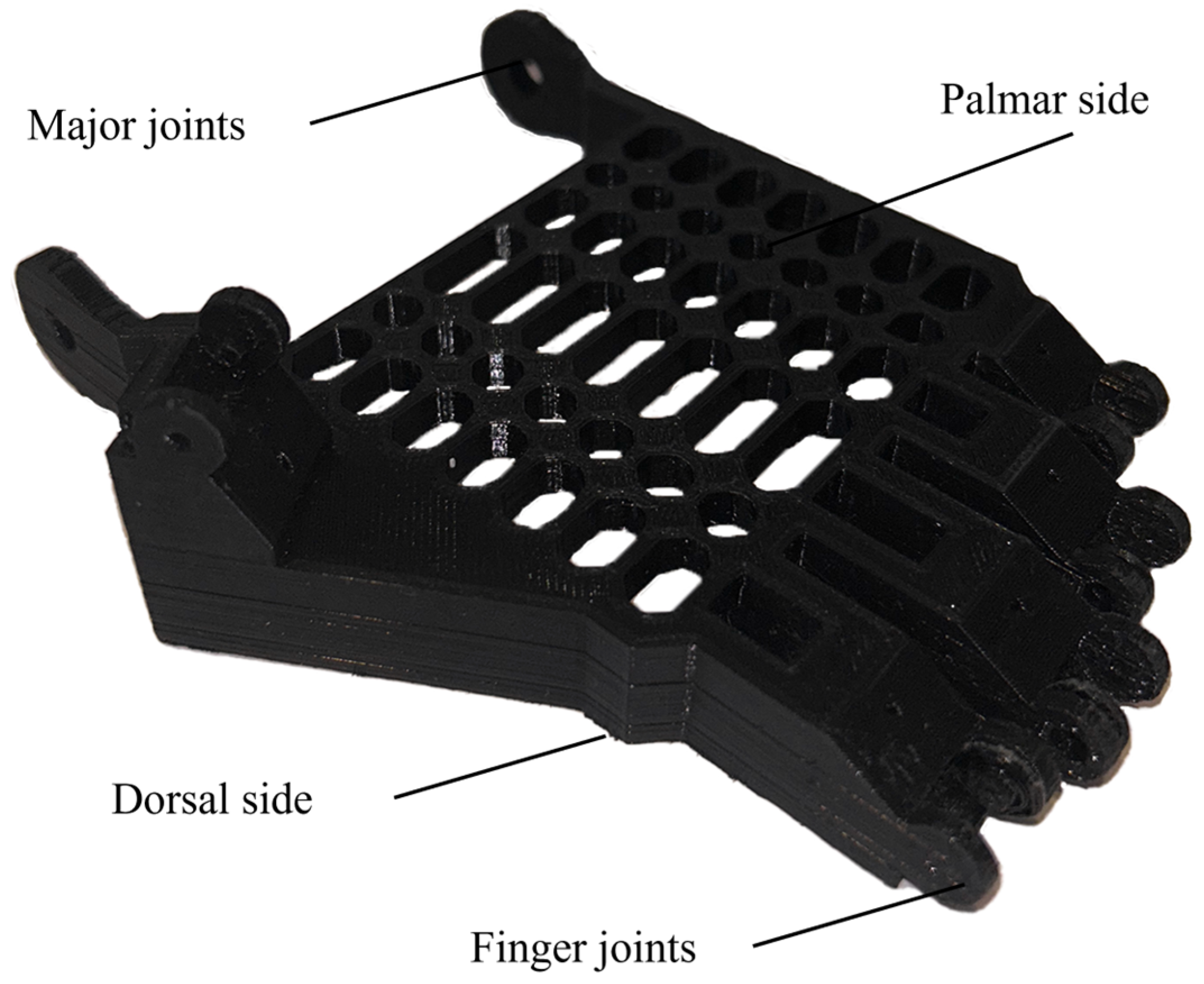 Development of a Low-Cost 3D-Printed Upper Limb Prosthetic Device with ...
