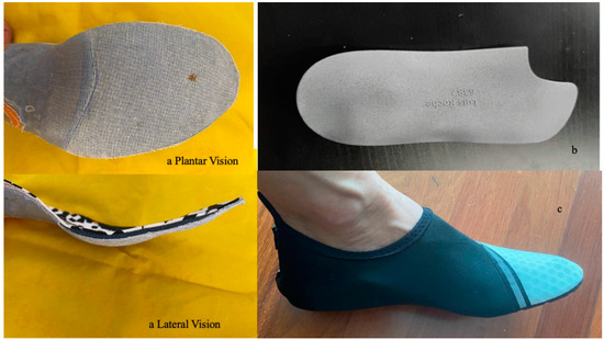 The Direct Impact Effect of Different Foot Orthotic Designs on the ...