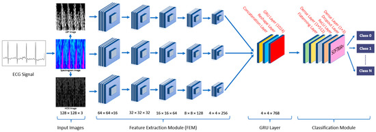 Spectrogram-Based Arrhythmia Classification Using Three-Channel Deep ...