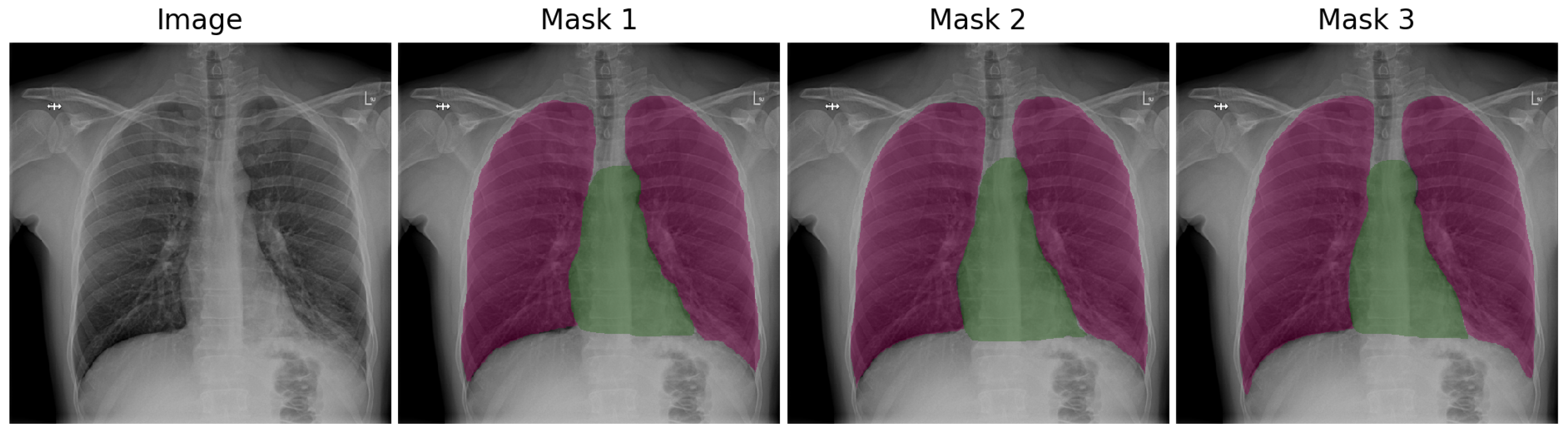Evaluating Uncertainty Quantification in Medical Image Segmentation: A ...
