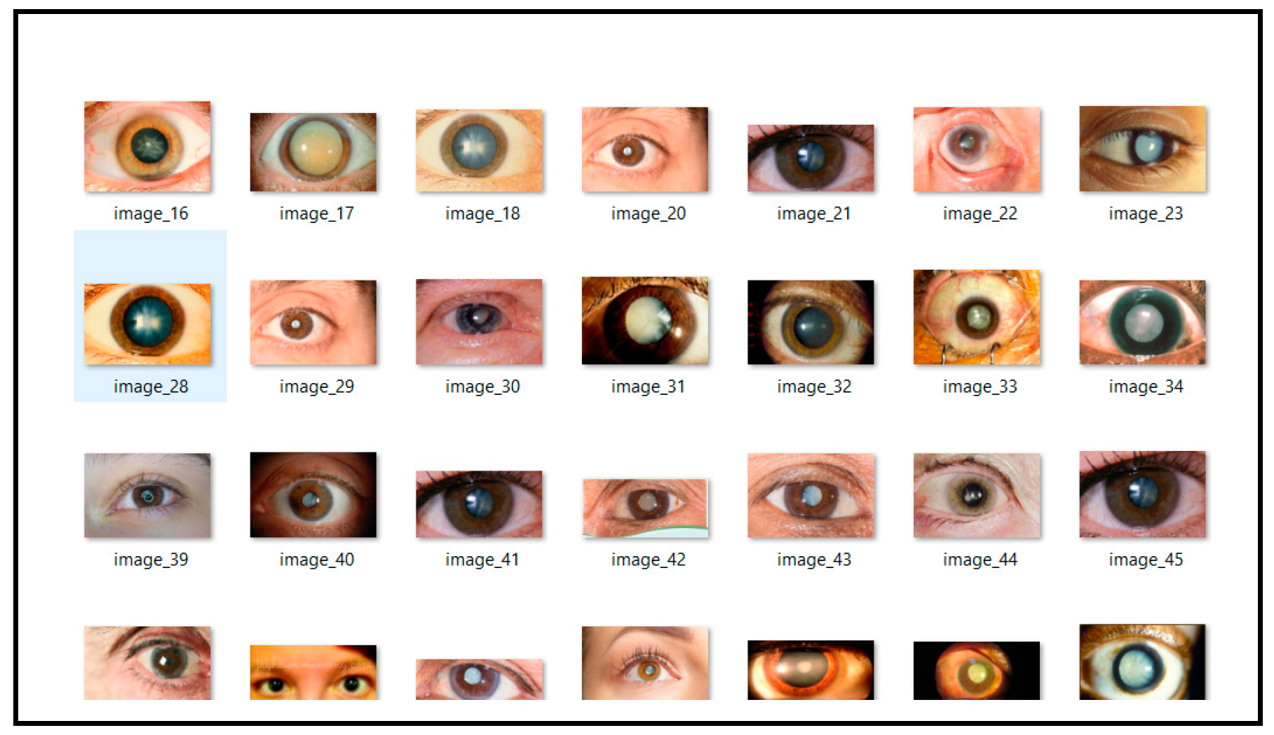Transformative Transparent Hybrid Deep Learning Framework for Accurate ...