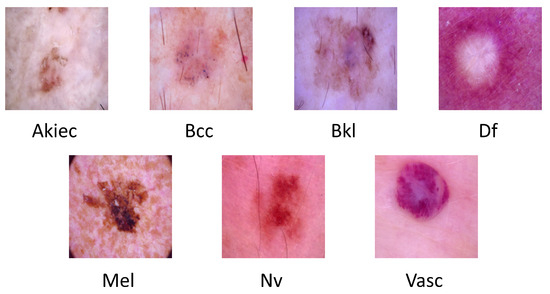 Enhancing Skin Lesion Classification Performance with the ABC Ensemble ...