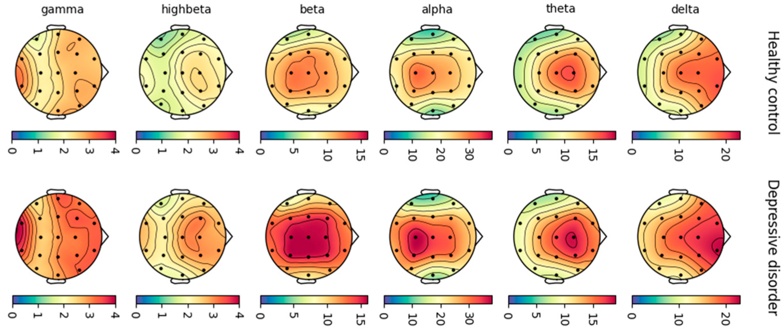 Impact of Feature Selection Techniques on the Performance of Machine Learning Models for ...