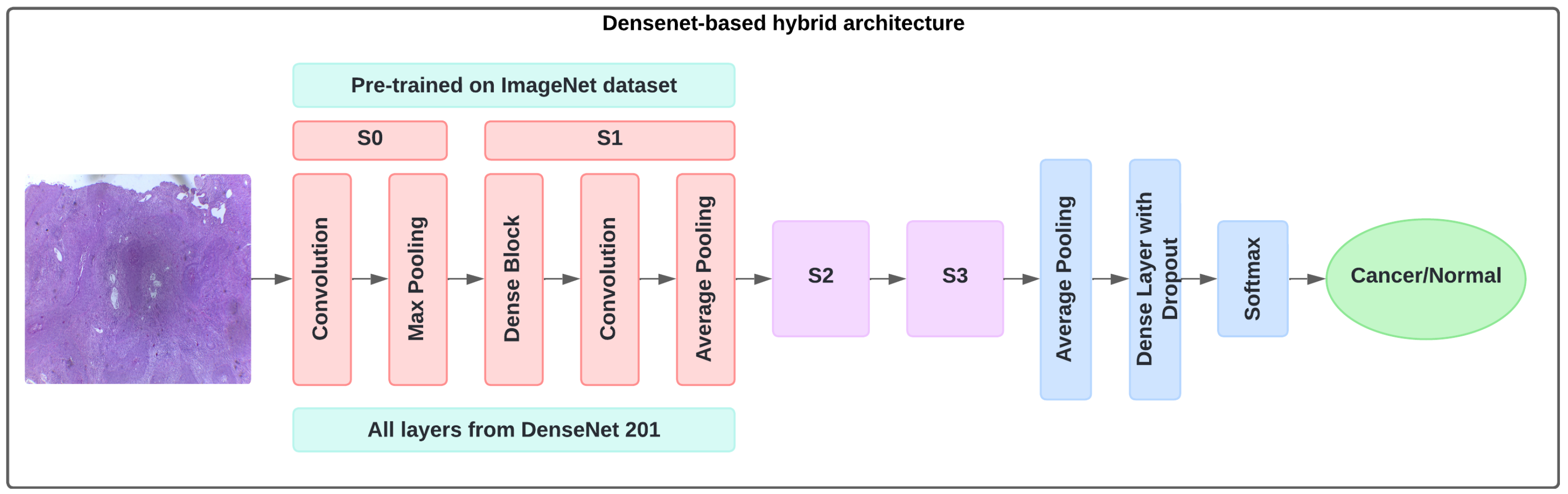 Building a DenseNet-Based Neural Network with Transformer and MBConv Blocks for Penile Cancer ...