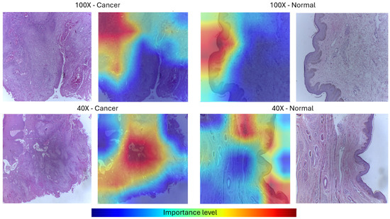 Building a DenseNet-Based Neural Network with Transformer and MBConv ...