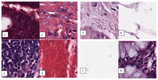 Machine Learning Models for the Classification of Histopathological ...
