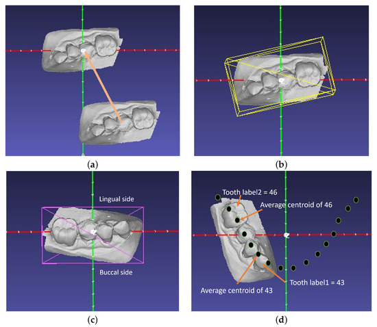 Robust Segmentation of Partial and Imperfect Dental Arches