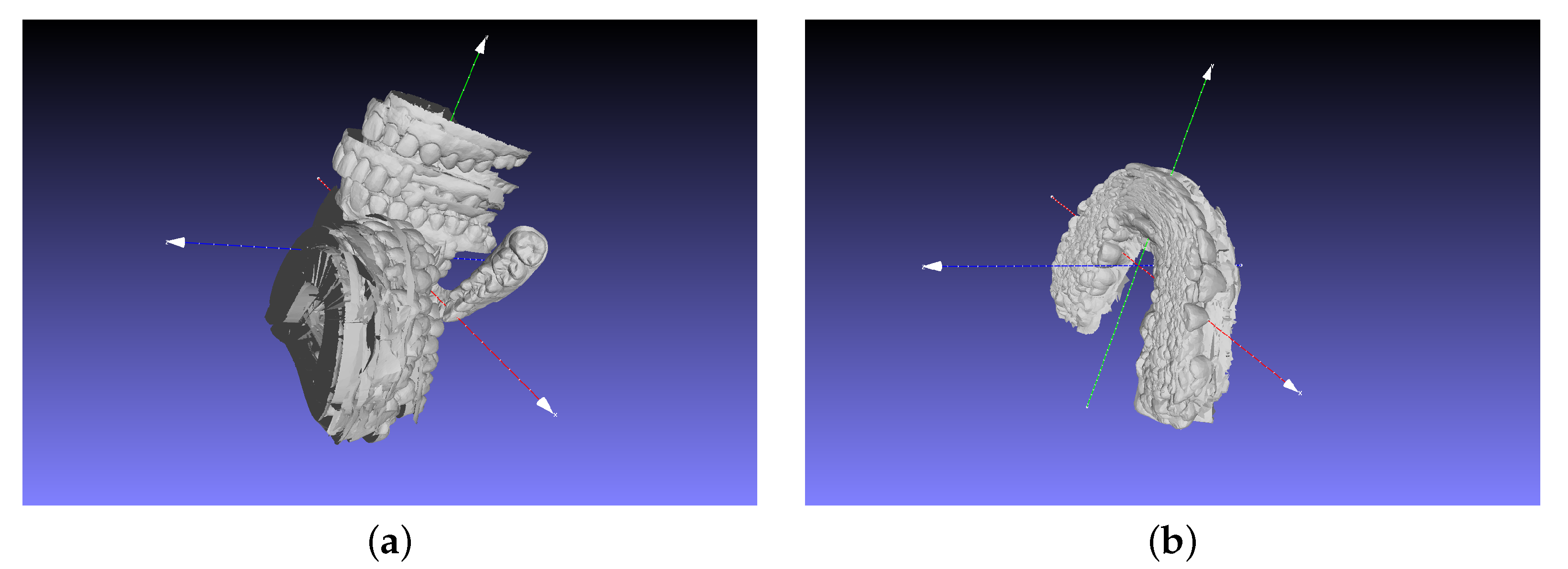 Robust Segmentation of Partial and Imperfect Dental Arches