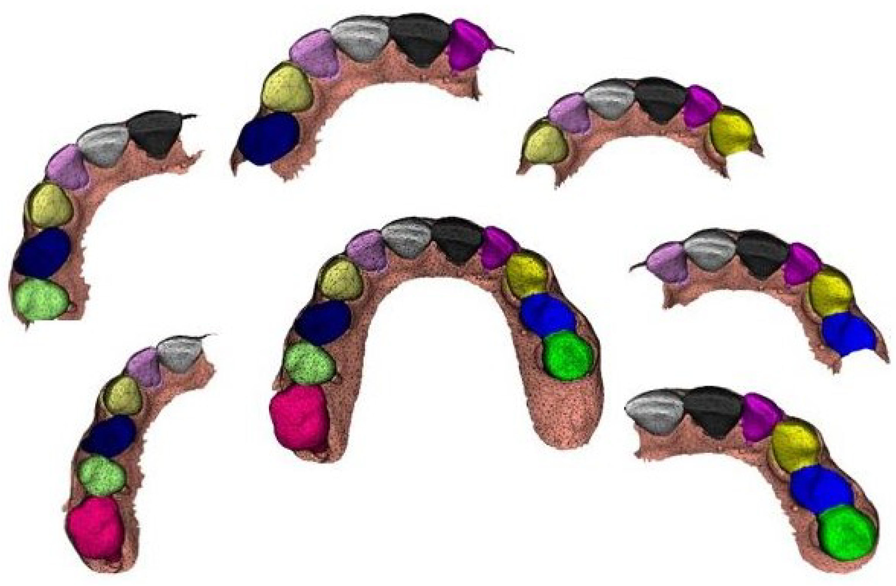 Robust Segmentation of Partial and Imperfect Dental Arches