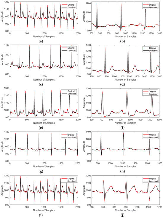 A Hybrid Approach to Enhanced Signal Denoising Using Data-Driven Multiresolution Analysis with ...