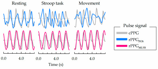 Improved Remote Photoplethysmography Using Machine Learning-Based ...