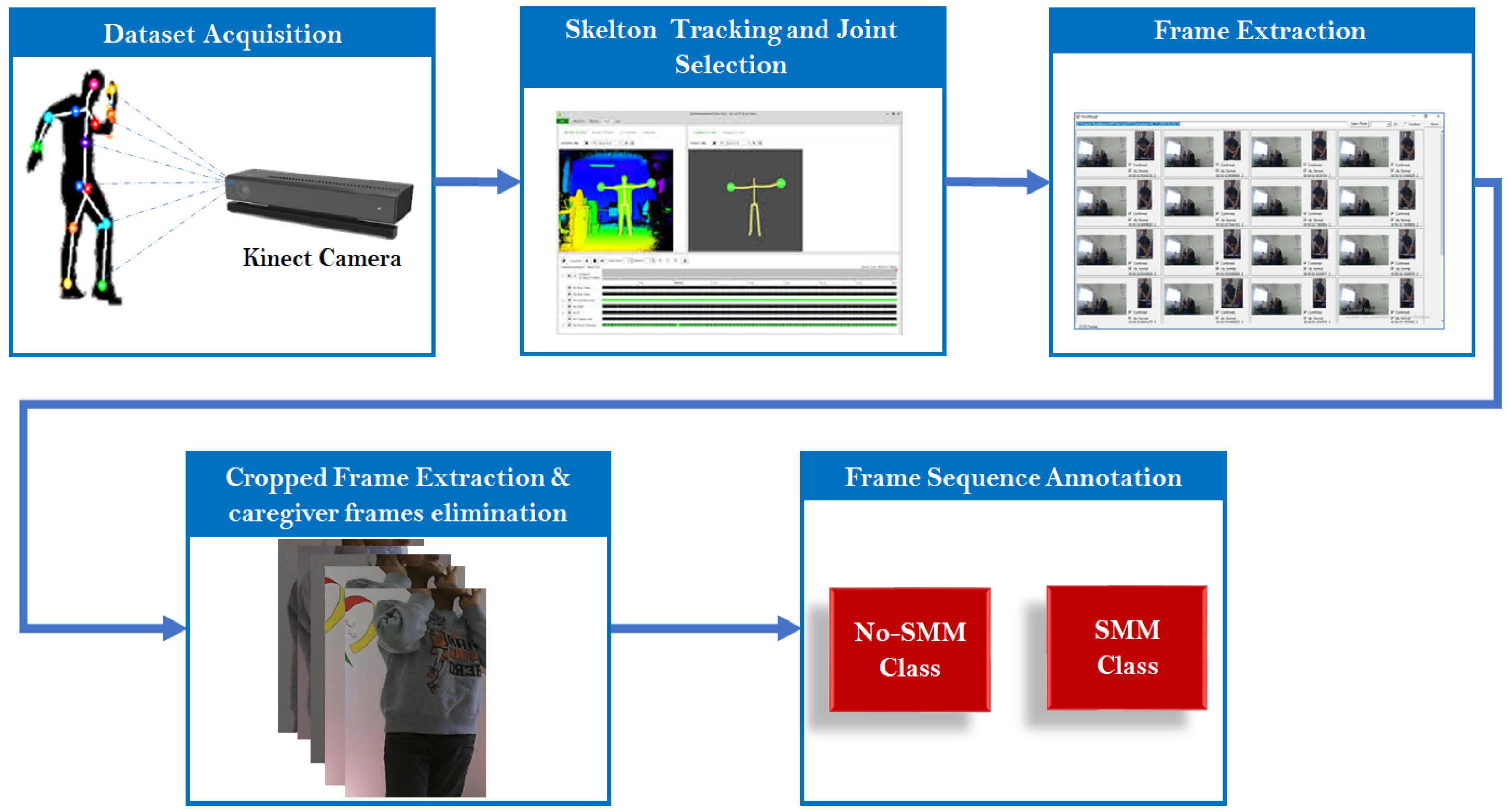 Hybrid 3D Convolutional–Transformer Model for Detecting Stereotypical ...
