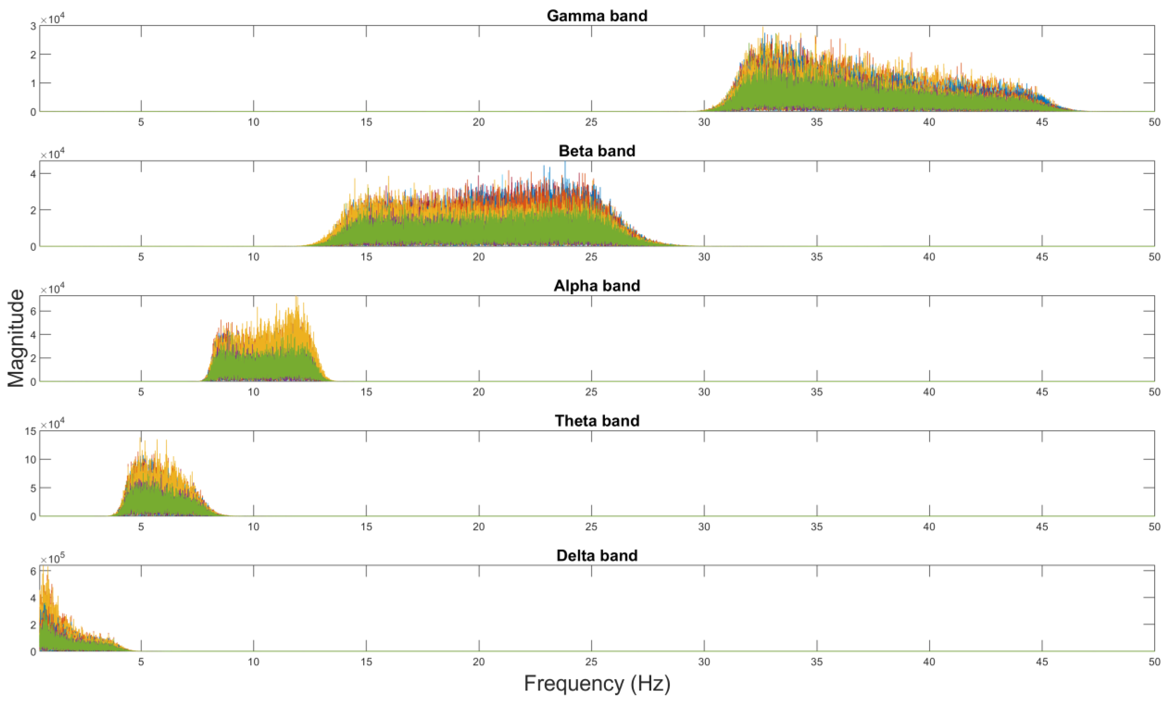 Impact of Sliding Window Overlap Ratio on EEG-Based ASD Diagnosis Using Brain Hemisphere Energy ...