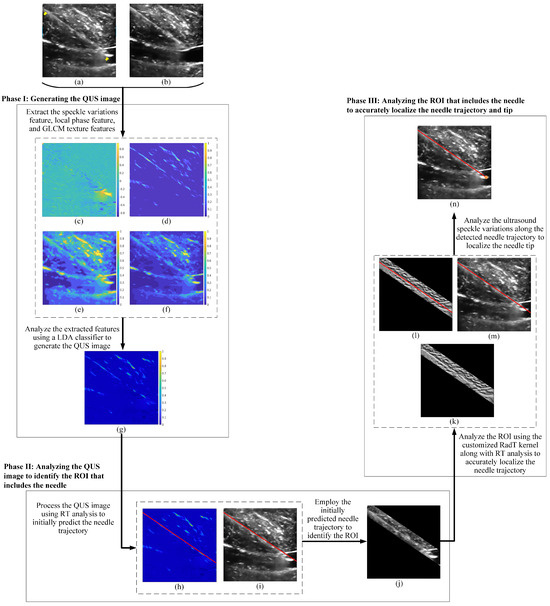 Accurate Needle Localization in the Image Frames of Ultrasound Videos