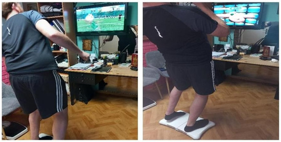 The Use of a Virtual Reality Training System on Gross Motor Function ...