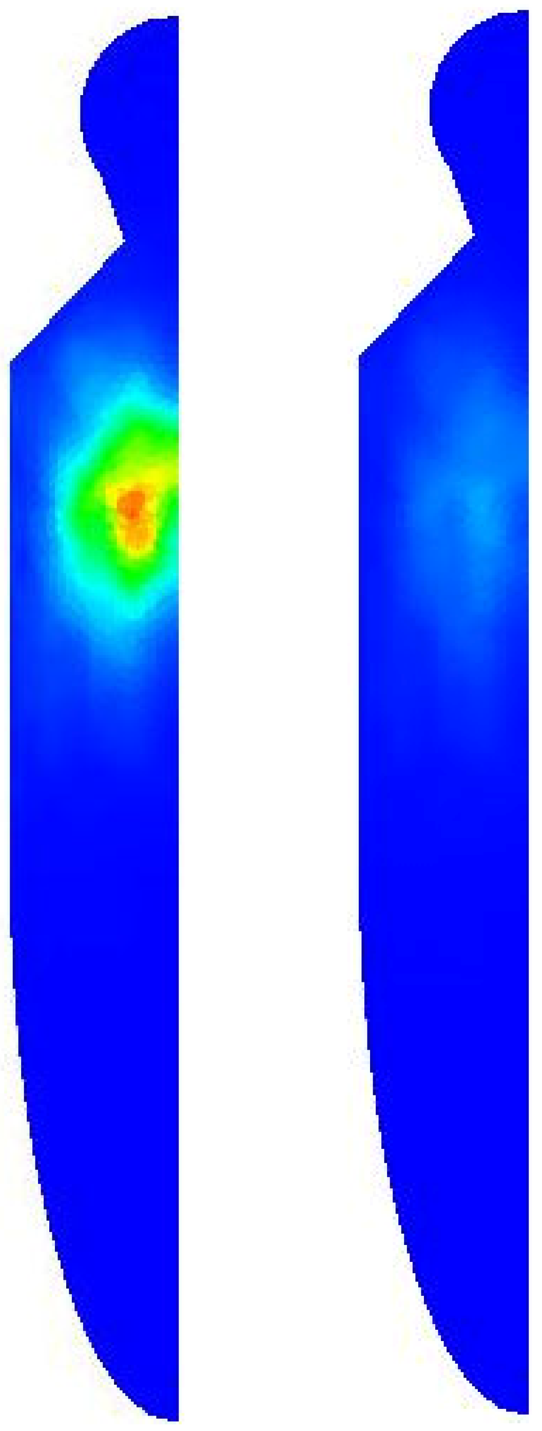 Applying Finite Element Method–Dirichlet Boundary Condition Iteration to the Computation of ...