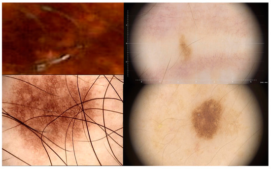Improving Medical Image Quality Using a Super-Resolution Technique with ...