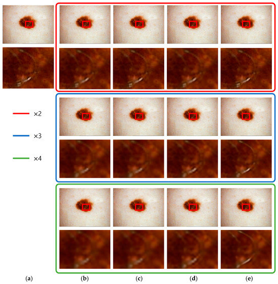 Improving Medical Image Quality Using a Super-Resolution Technique with ...