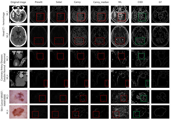 Contrast-Invariant Edge Detection: A Methodological Advance in Medical ...