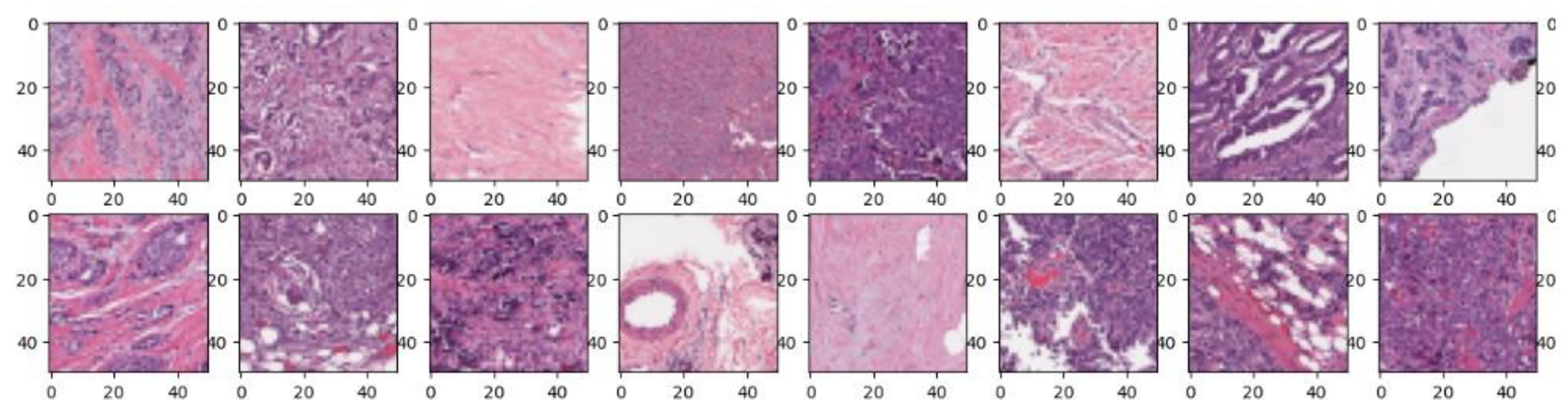 Effectiveness Analysis of Deep Learning Methods for Breast Cancer ...
