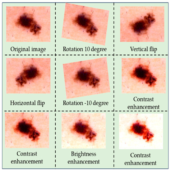 A Trustworthy Framework for Skin Cancer Detection Using a CNN with a ...