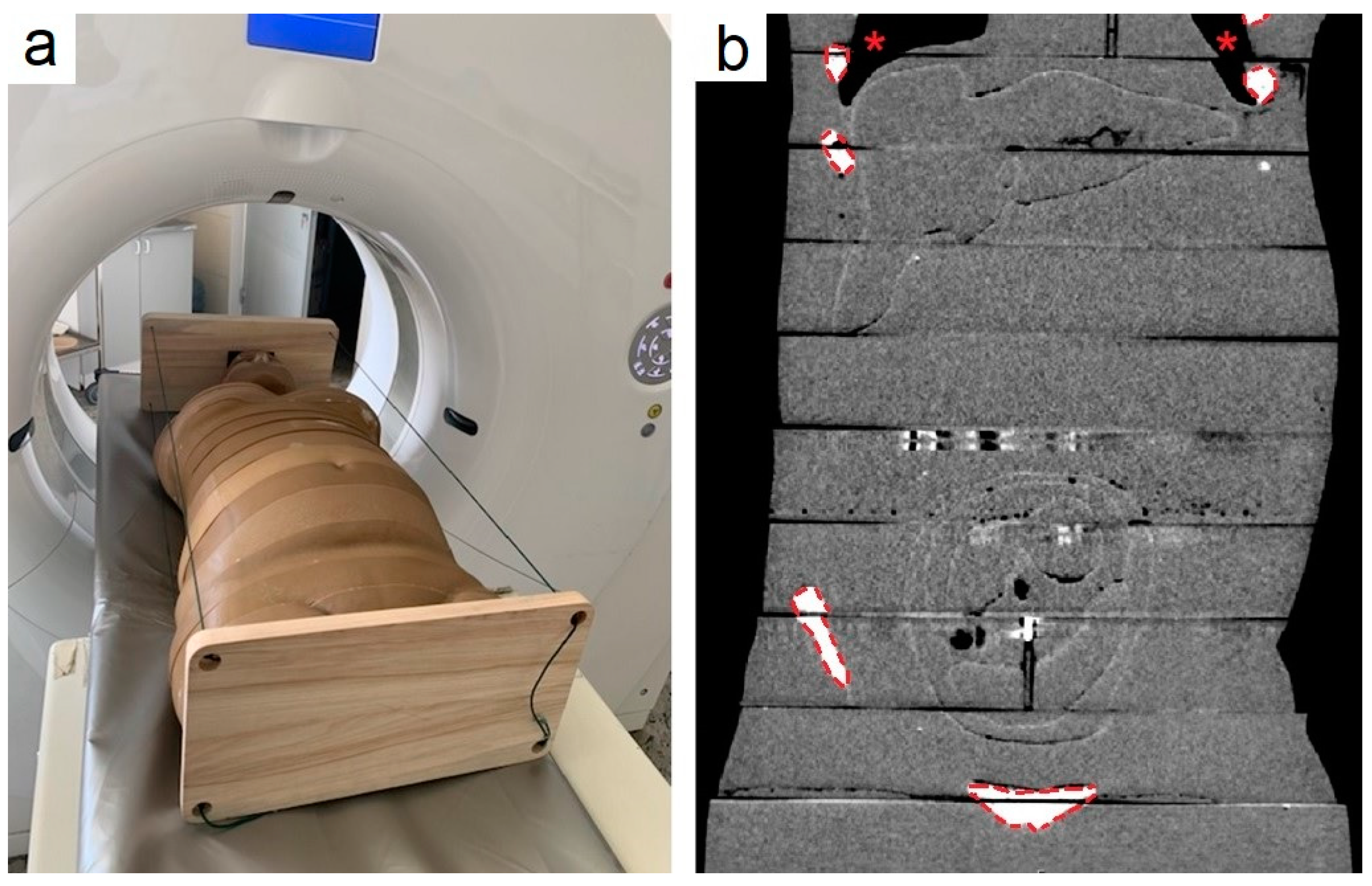 Fetal Radiation Dose in Common Diagnostic Radiology Procedures for ...