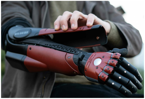 Review of Robotic Prostheses Manufactured with 3D Printing: Advances ...