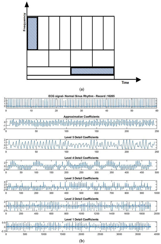 Assessing Cardiac Sympatho-Vagal Balance Through Wavelet Transform ...