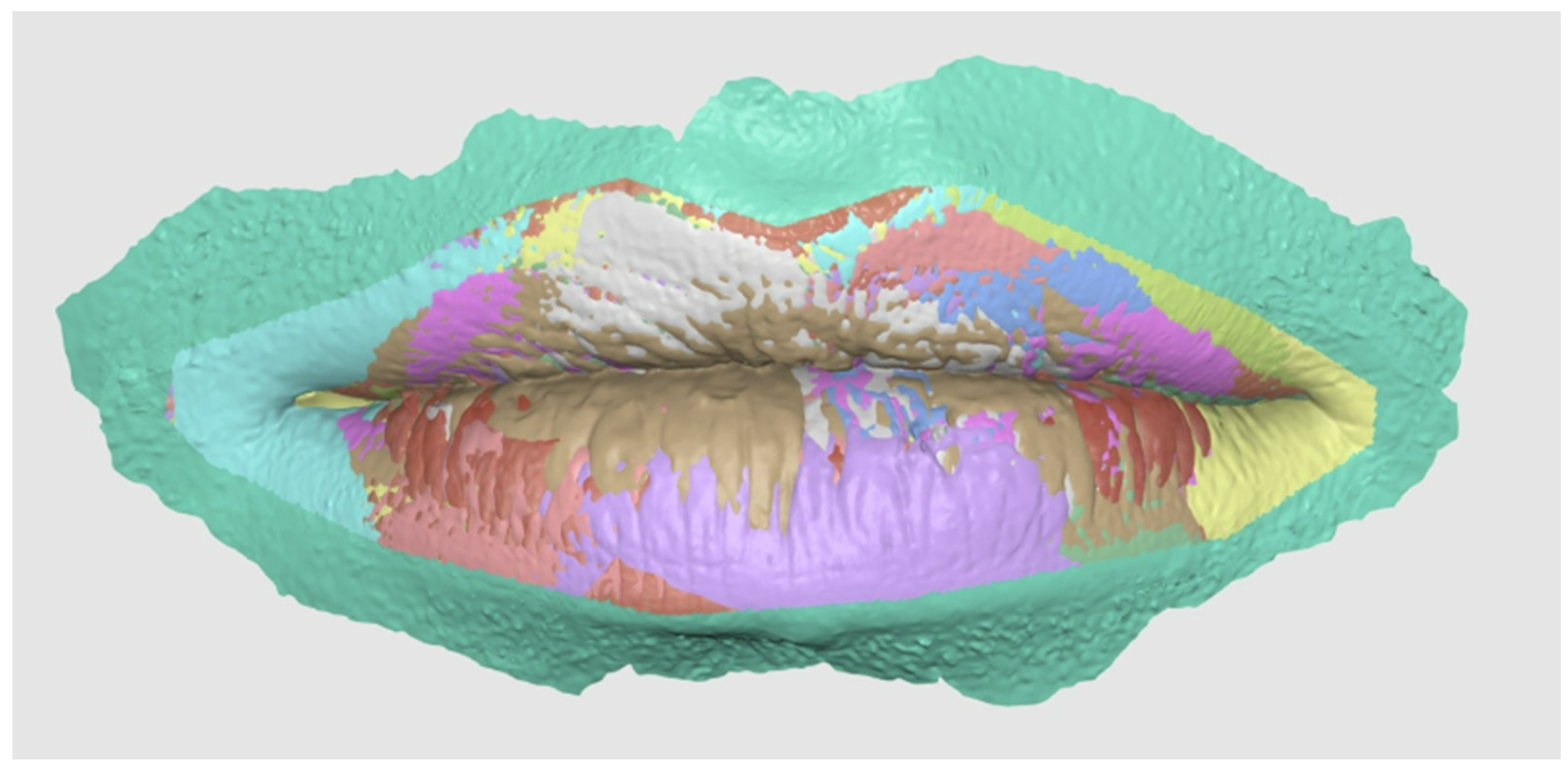 Preliminary Insights into 3D Cheiloscopy for Forensic Applications: A ...