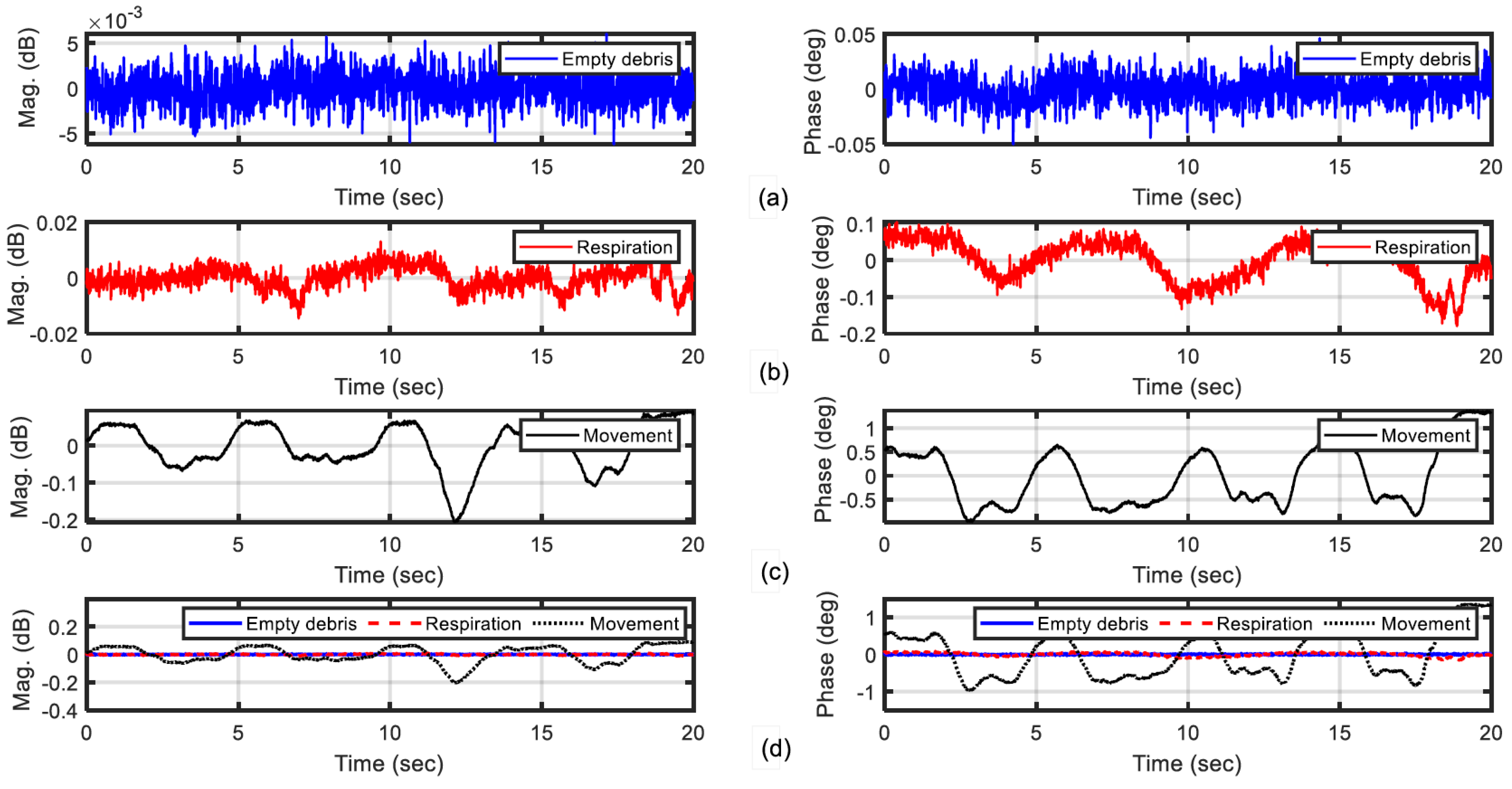 Human Respiration and Motion Detection Based on Deep Learning and Signal Processing Techniques ...