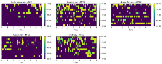 Baby Cry Classification Using Structure-Tuned Artificial Neural ...