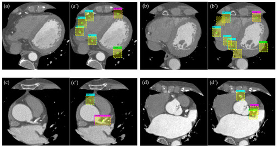 Automated Coronary Artery Identification in CT Angiography: A Deep Learning Approach Using ...