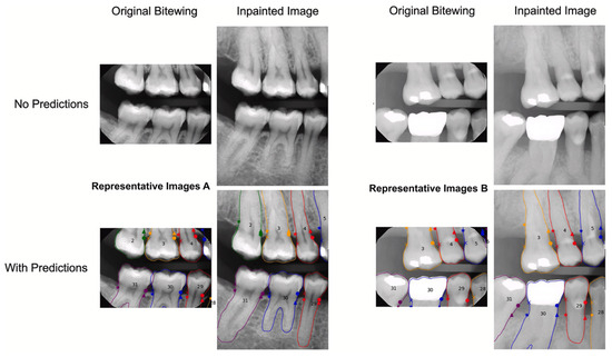 Revolutionizing Periodontal Care: The Role of Artificial Intelligence ...