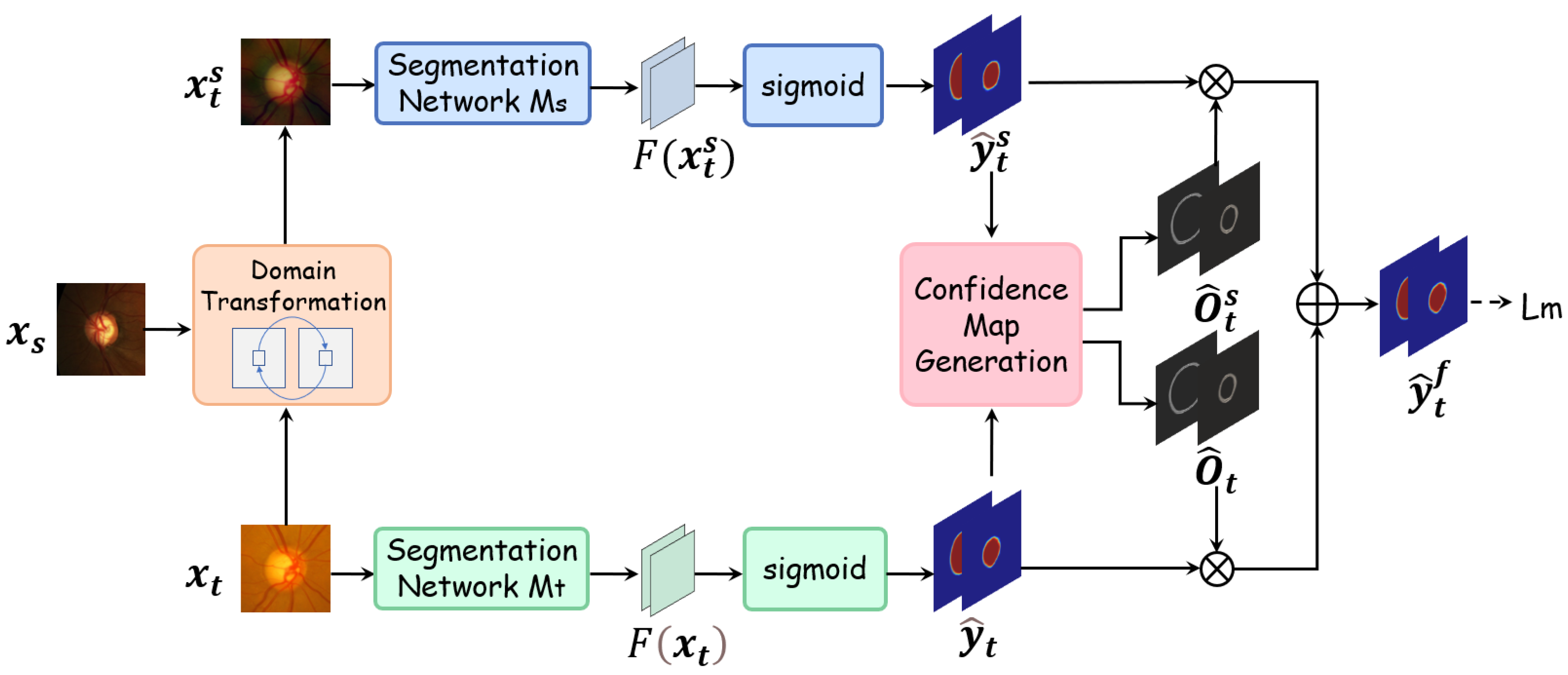 Causal Inference-Based Self-Supervised Cross-Domain Fundus Image Segmentation