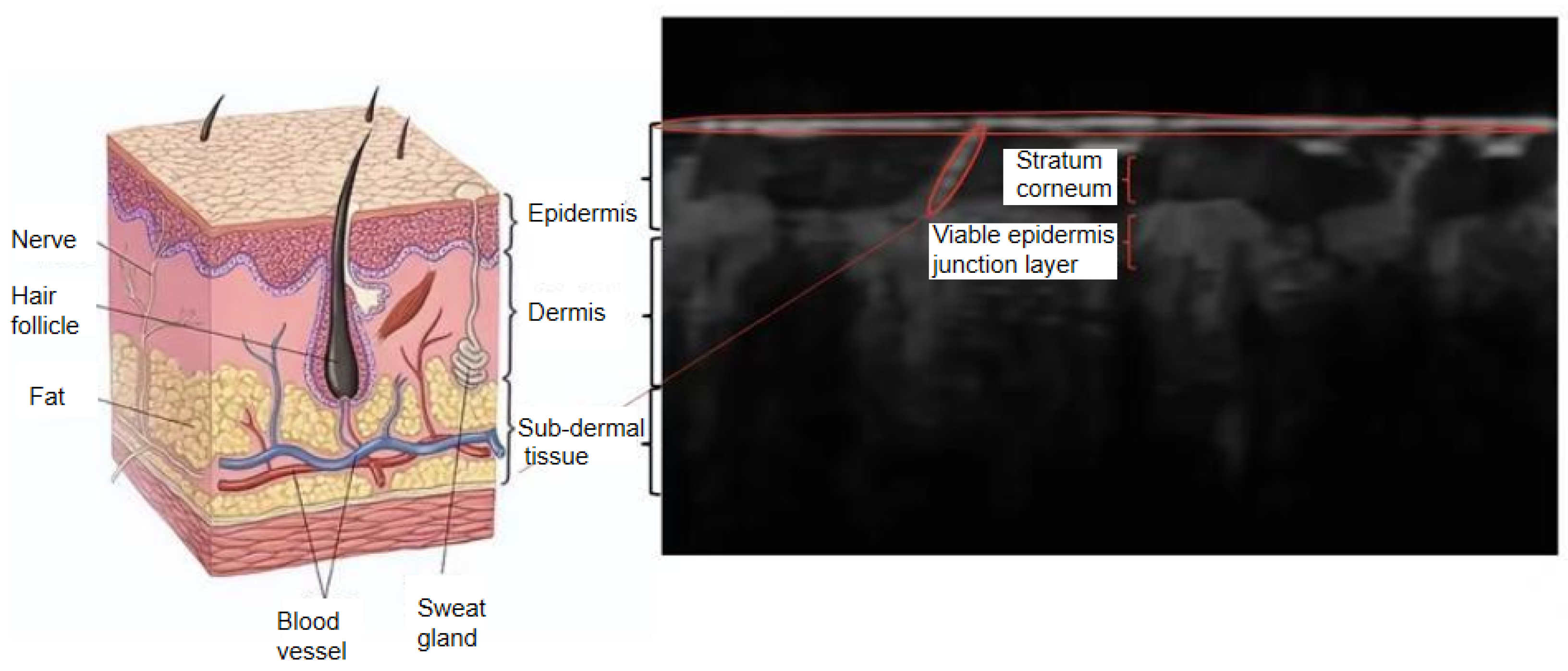 Optical Coherence Tomography-Based Fingerprint Presentation Attack ...