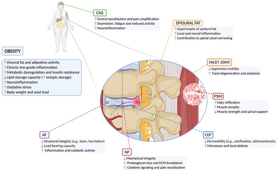 The Vicious Cycle of Obesity and Low Back Pain: A Comprehensive Review