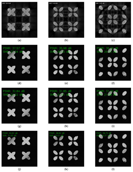 A Hybrid Framework for Metal Artifact Suppression in CT Imaging of ...