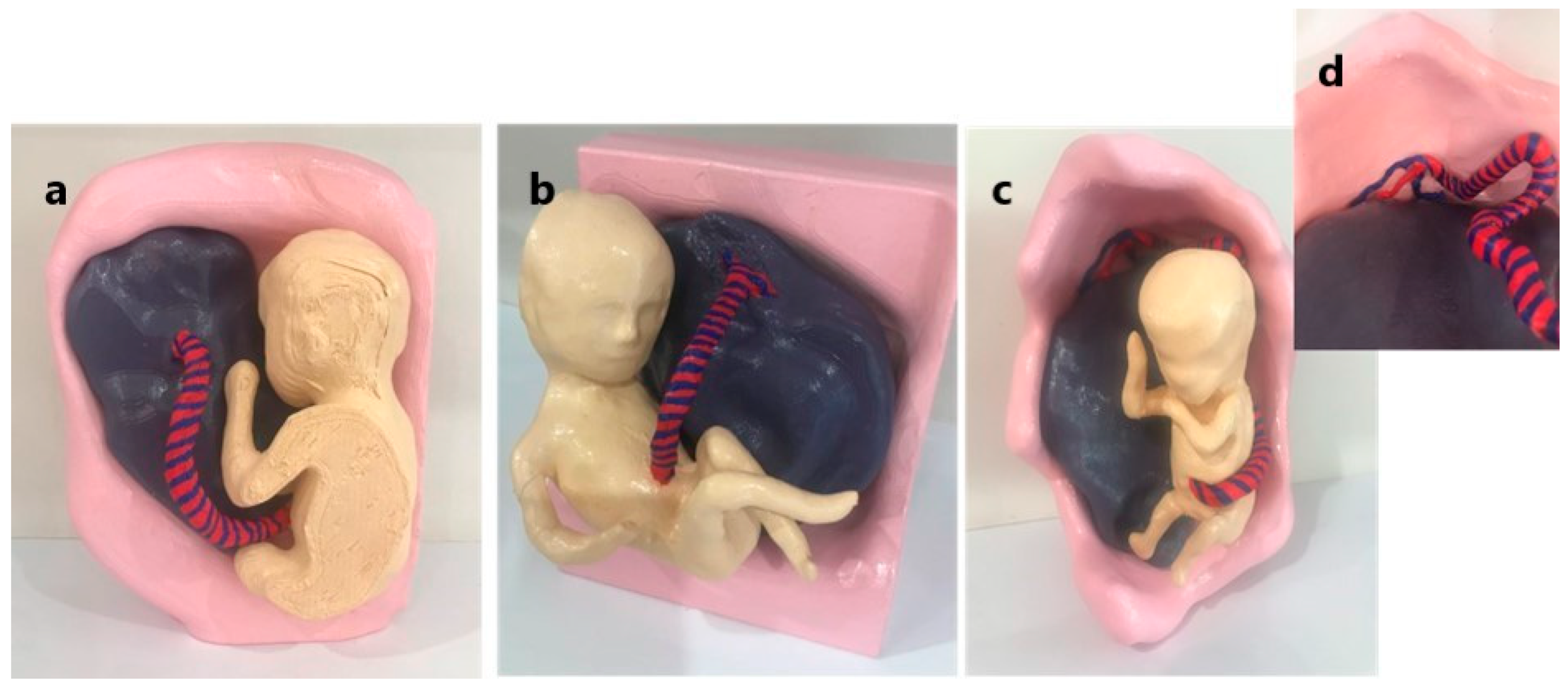 Three-Dimensional-Printed Models: A Novel Approach to Ultrasound ...